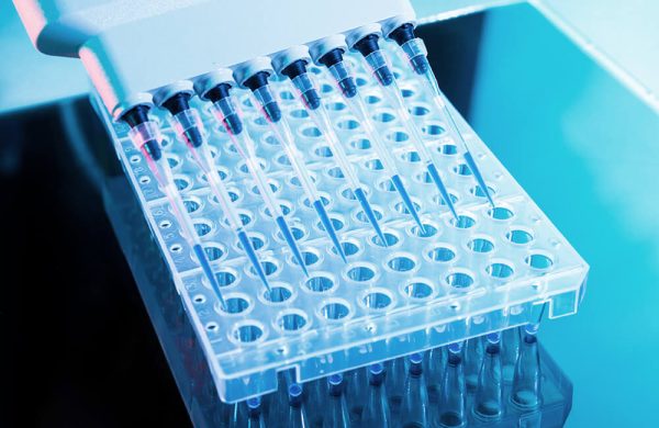 What is the Y-DNA SNP test? - DNA Archaeology